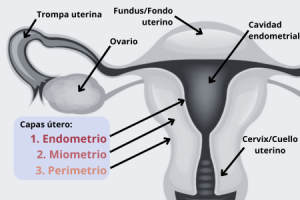 Mioma FIGO clasificación: 9 tipos de miomas