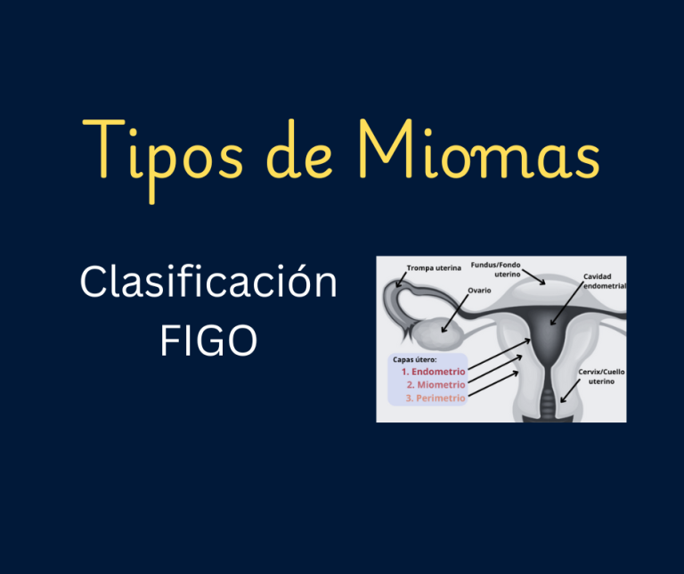 Miomas - Dr Diego Ortega